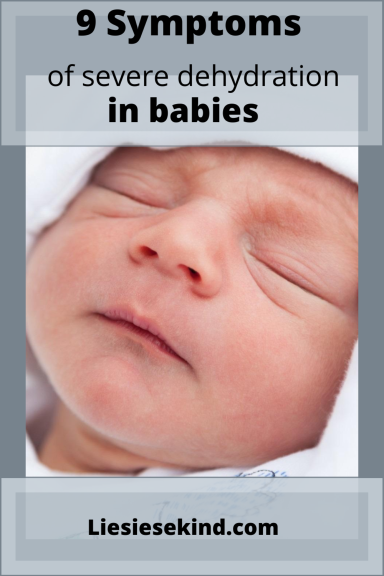 9 Symptoms Of Severe Dehydration In Infants - Liesie Se Kind